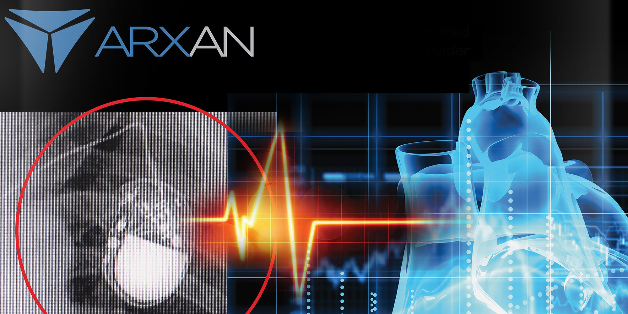 Arxan - Agency Orange